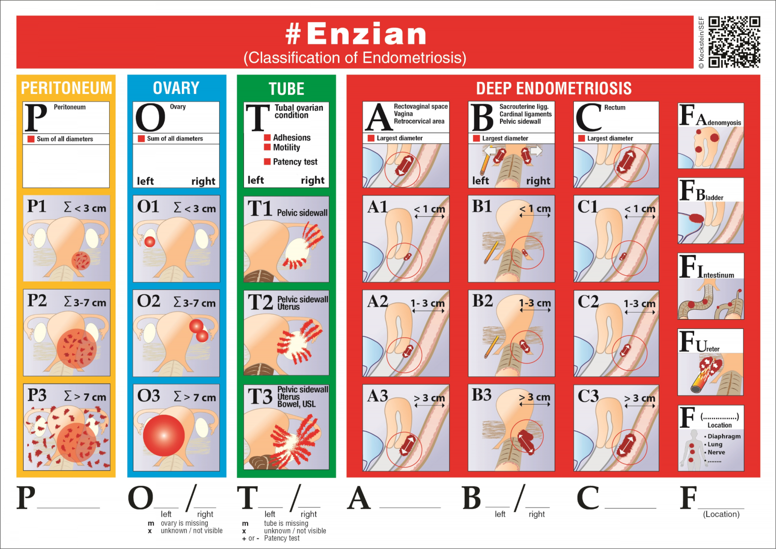 # Enzian - Stiftung Endometriose Forschung